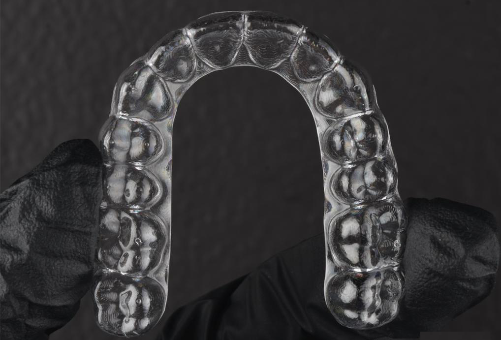 Qualident Aligners – You smile, I smile , We all smile!